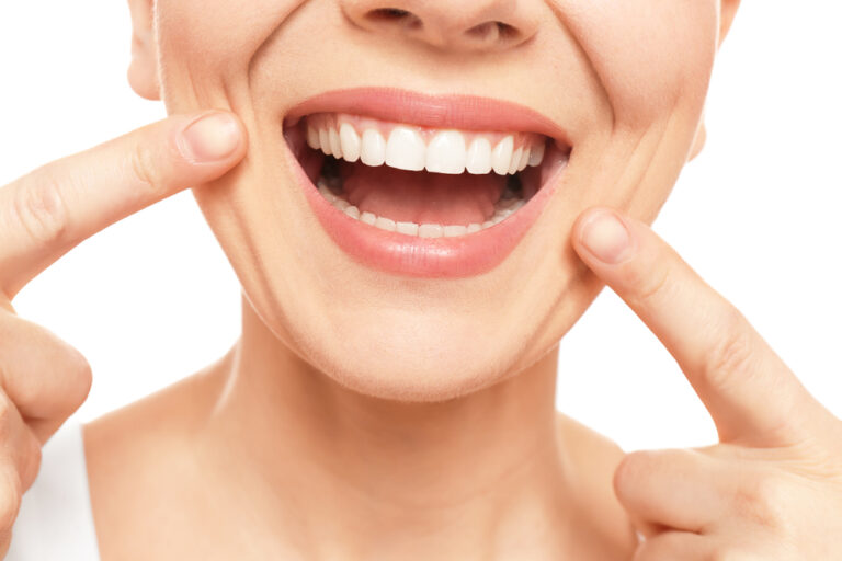 beginning stages of gingivitis